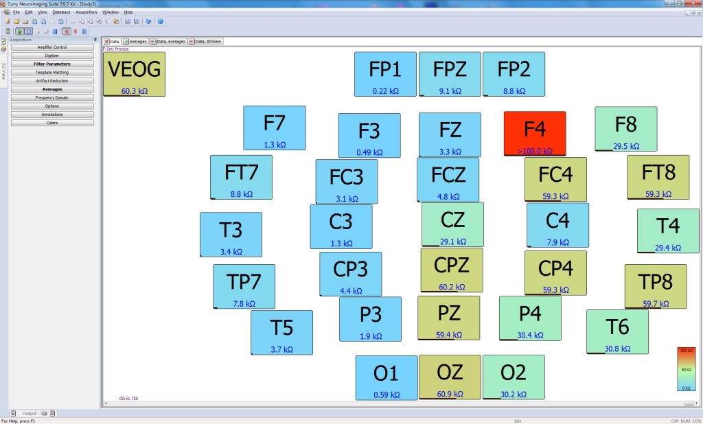Neuvo - Compumedics Neuroscan