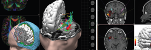 Compumedics Neuroscan – World Leader in Functional Neuro-imaging