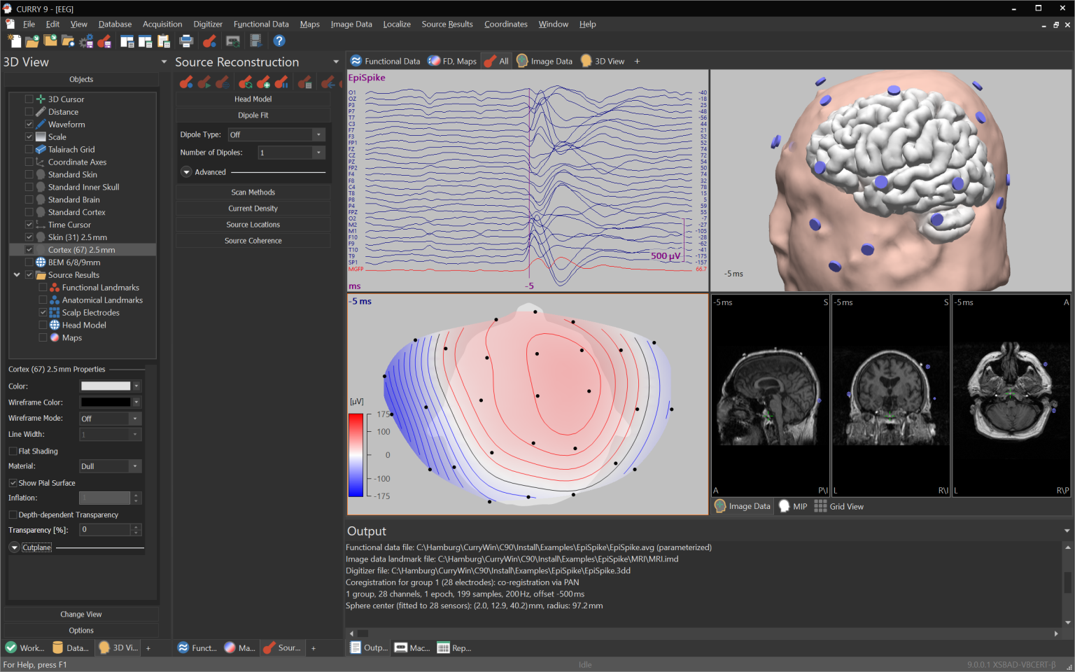 Upgrade to CURRY 9 – Compumedics Neuroscan