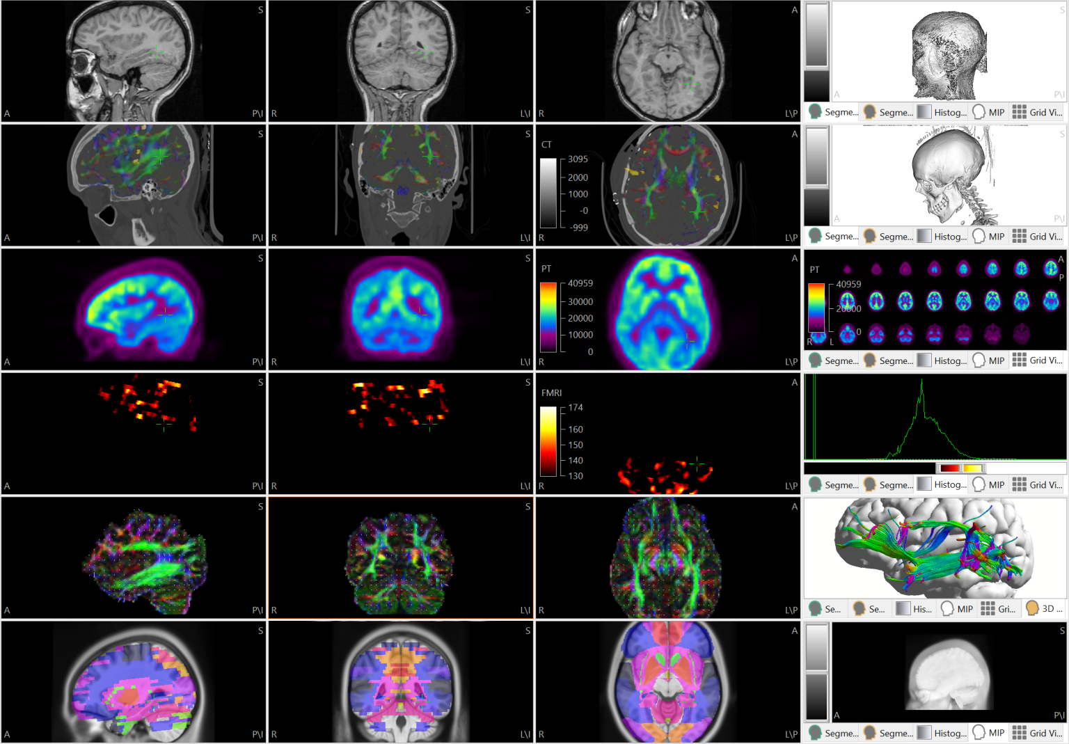 Upgrade to CURRY 9 – Compumedics Neuroscan