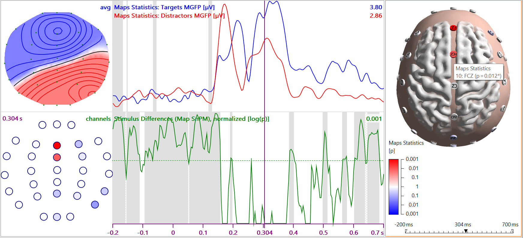 Upgrade to CURRY 9 – Compumedics Neuroscan
