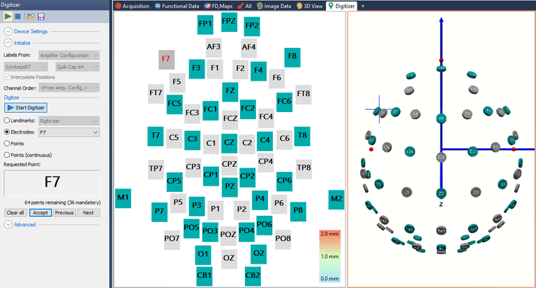Electrode Digitization – Compumedics Neuroscan