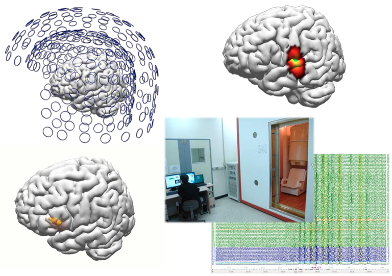 Compumedics Neuroscan Proudly Announces the Introduction of Orion ...