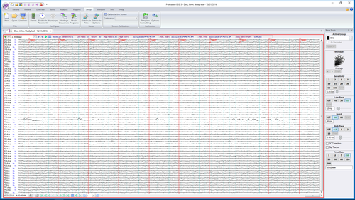 Profusion EEG Recording – Compumedics Neuroscan